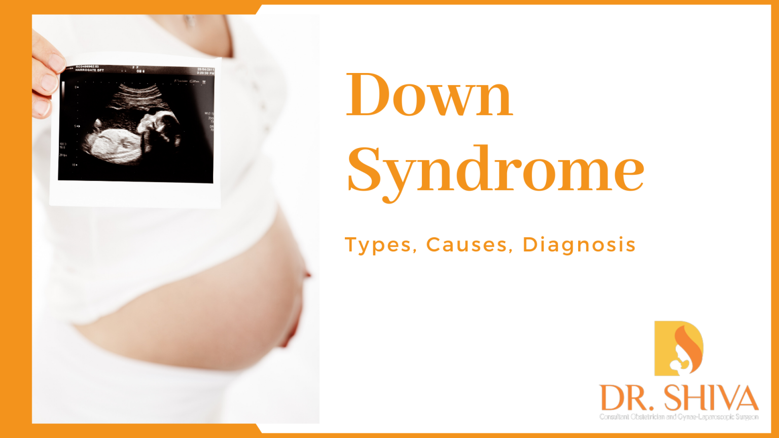 Down Syndrome: Types, Causes and Treatment| Dr. Shiva