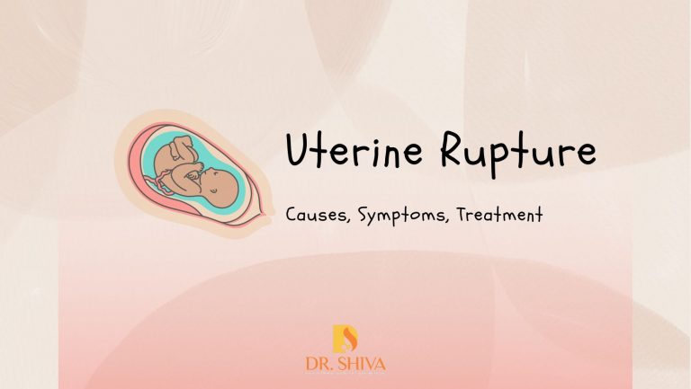 Uterine Rupture | Childbirth complications | Treatment