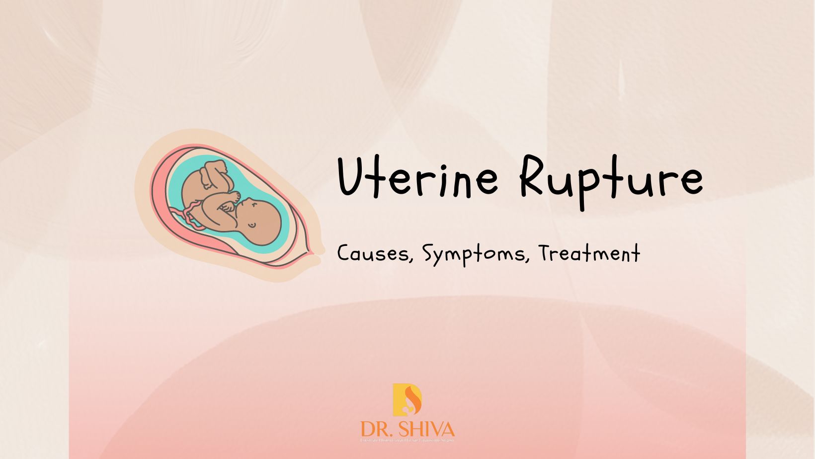 Uterine Rupture | Childbirth complications | Treatment Uterine Rupture | Childbirth complications | Treatment