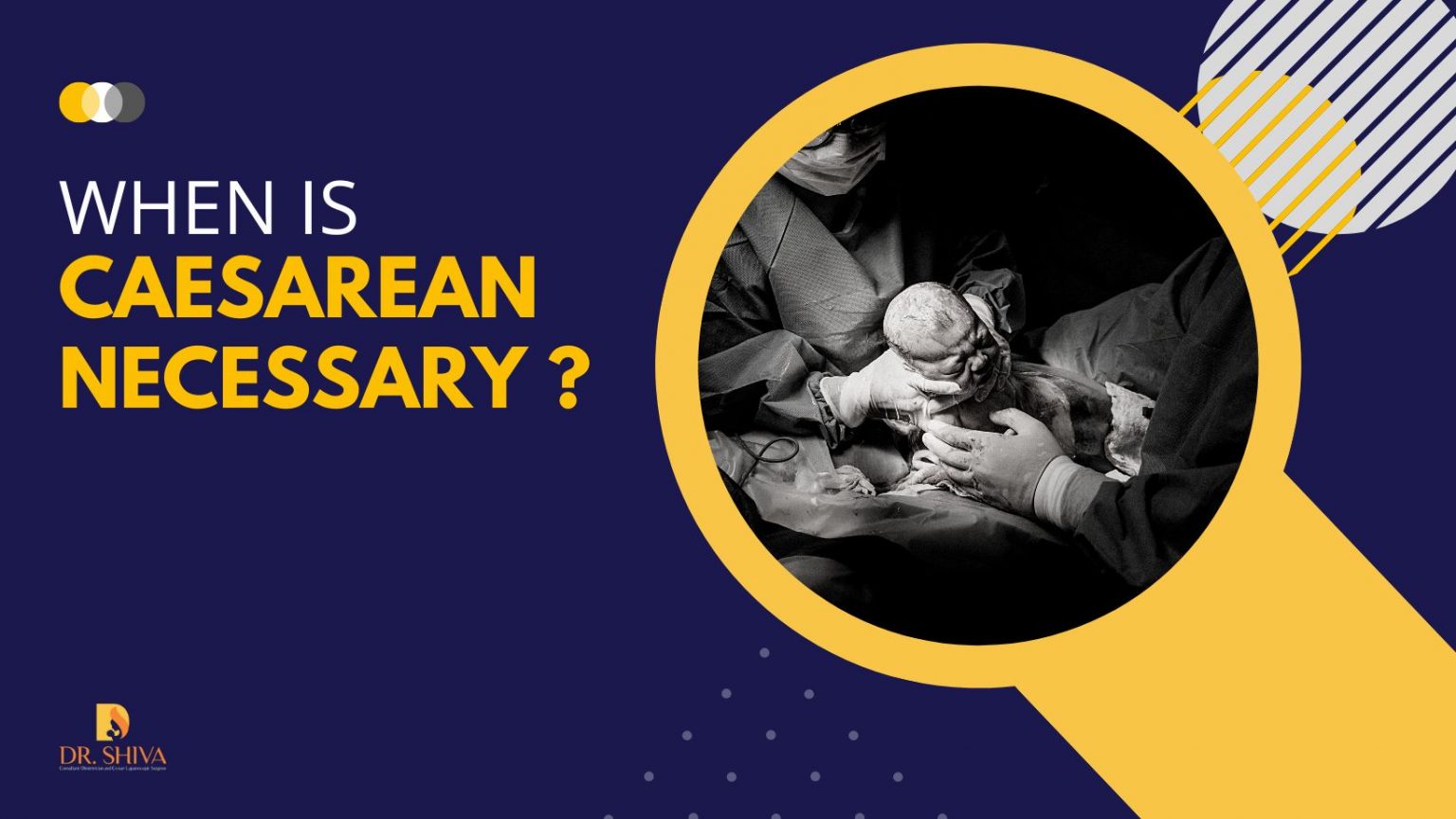 Cesarean, when are they needed and why? | Risk and Preparations