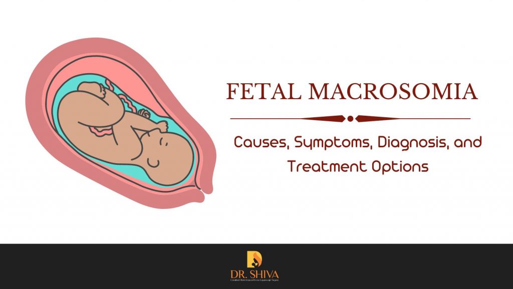 Fetal Macrosomia: Causes, Symptoms, Diagnosis & Treatment | Fetal ...