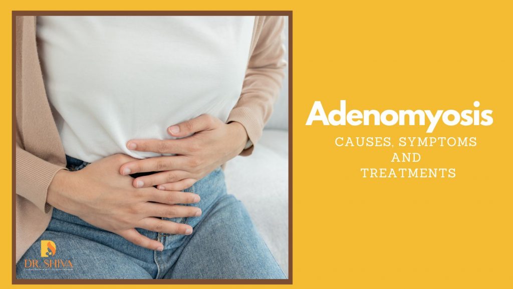 Understanding Adenomyosis Symptoms Causes Diagnosis And Treatment 9239
