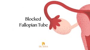 Blocked Fallopian Tubes: Understanding Causes, Diagnosis, and Treatment ...