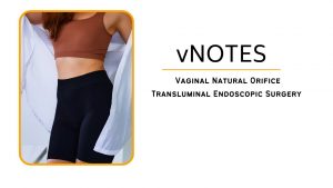 VNOTES - Vaginal Natural Orifice Transluminal Endoscopic Surgery - Dr ...